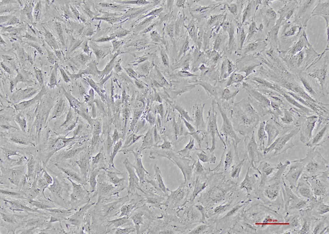 人卵巢颗粒细胞瘤细胞(KGN)，STR鉴定正确，冻存细胞,KGN Cells, correctly identified by STR 生命科学产品与技术服务-生工生物工程(上海)股份有限公司