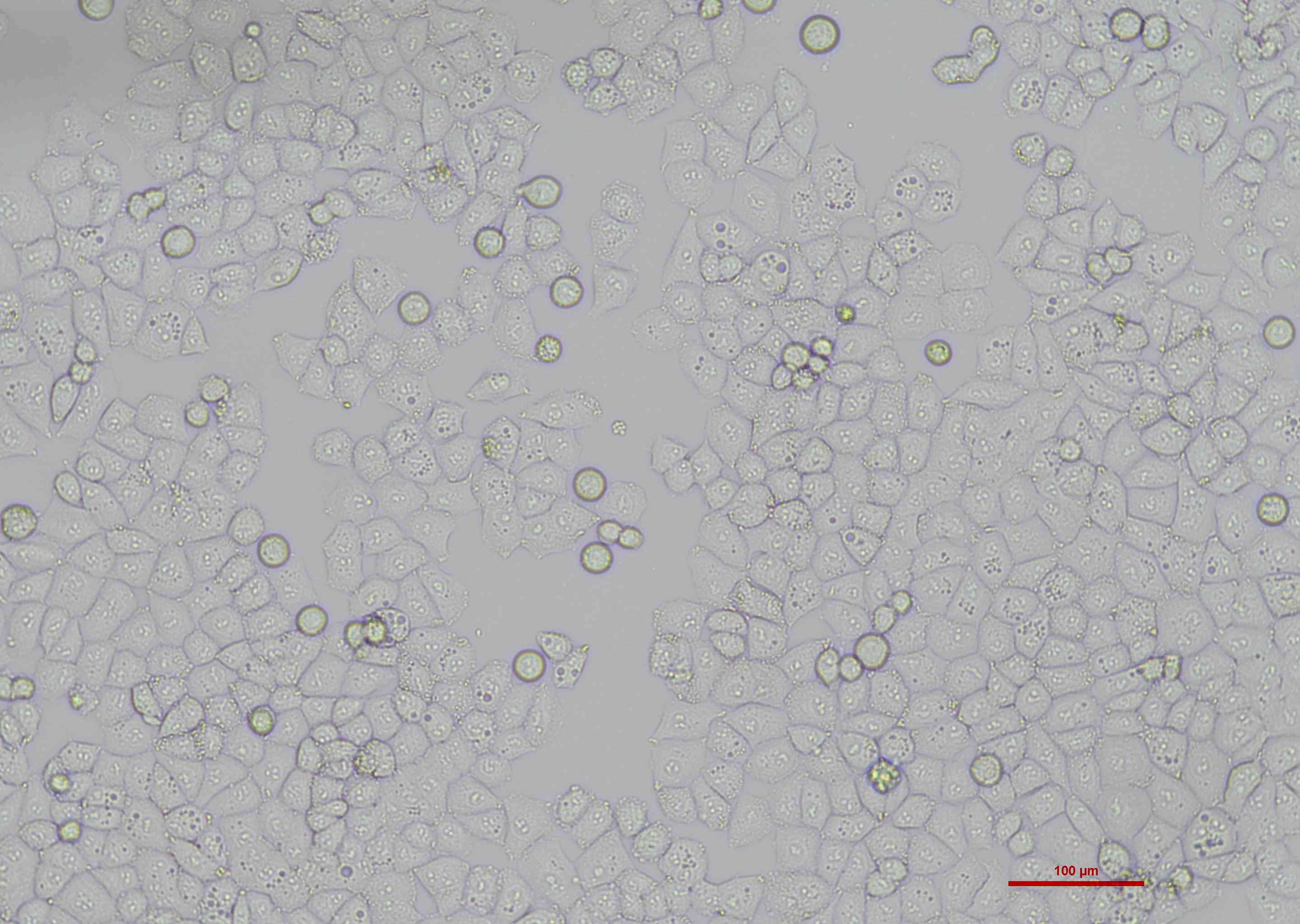 人正常卵巢上皮细胞(IOSE-80）,冻存细胞,IOSE-80 Cells 生命科学产品与技术服务-生工生物工程(上海)股份有限公司