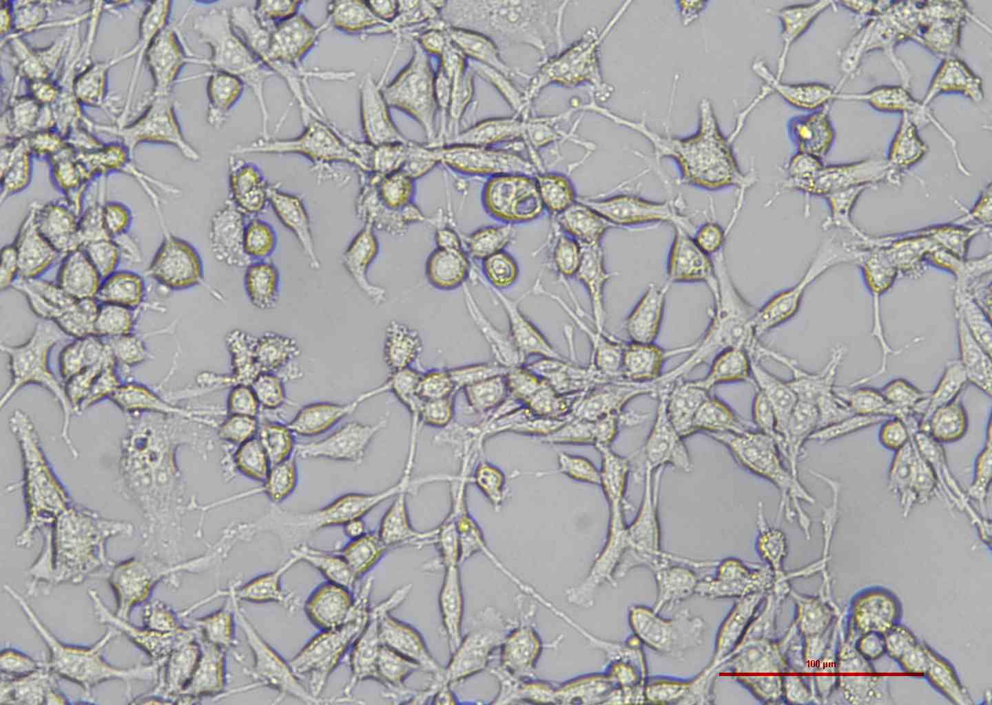 人乳腺癌细胞(MDA-MB-436)，STR鉴定正确，常温细胞,MDA-MB-436 Cells, correctly identified by STR 生命科学产品与技术服务-生工生物工程 ...