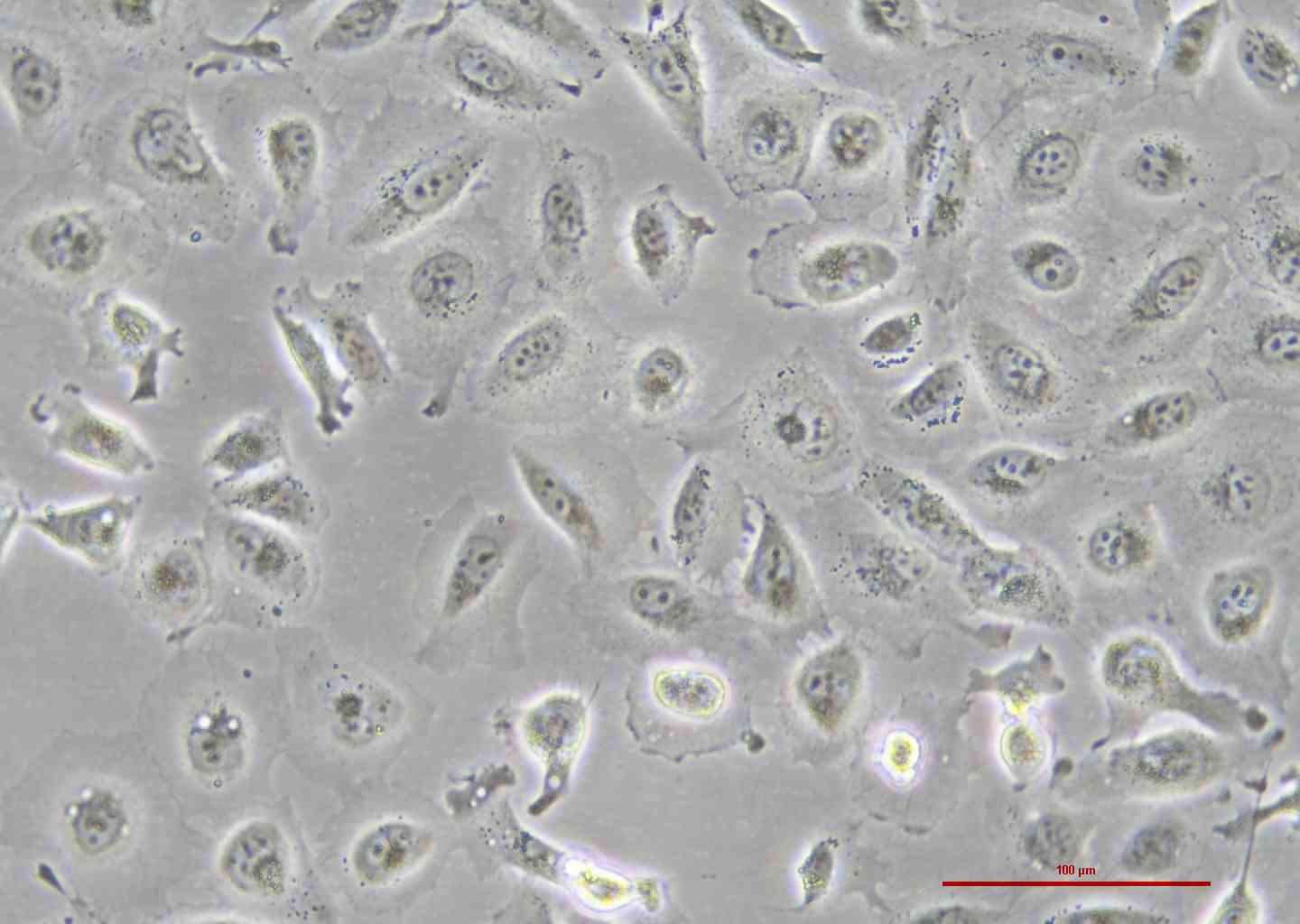 人正常胰腺导管上皮细胞系(HPDE6-C7)，STR鉴定正确，常温细胞,HPDE6-C7 Cells, correctly ...