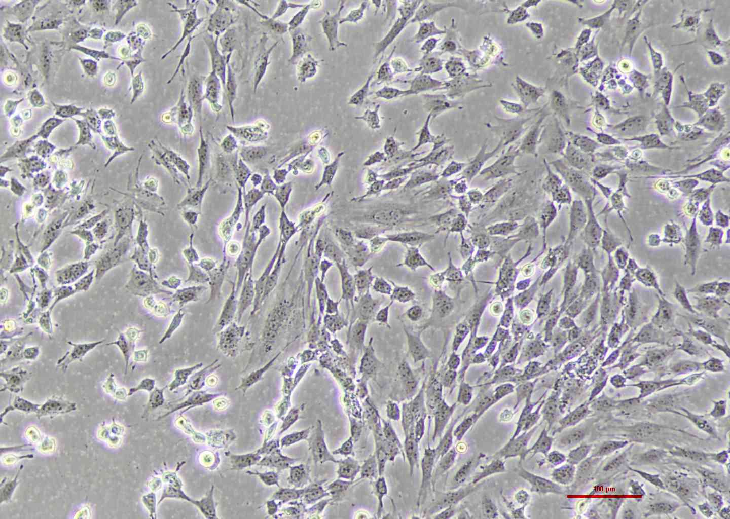小鼠视网膜神经节细胞(RGC-5（661W）)，STR鉴定正确，常温细胞,RGC-5（661W） Cells， correctly identified by STR 生命科学产品与技术服务 ...