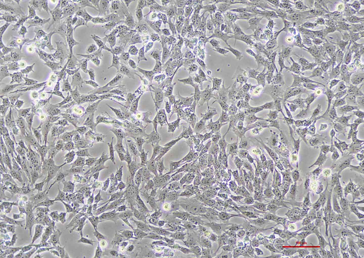 小鼠视网膜神经节细胞(RGC-5（661W）)，STR鉴定正确，常温细胞,RGC-5（661W） Cells， correctly identified by STR 生命科学产品与技术服务 ...
