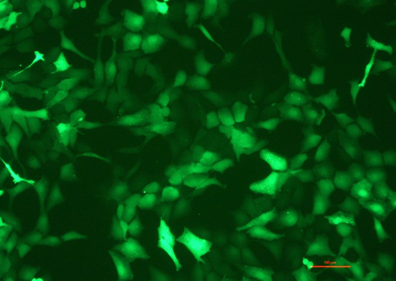 人卵巢癌细胞EMP1干扰细胞株-绿色荧光标记(SKOV3 sh-EMP1-EGFP)，STR鉴定正确，冻存细胞,SKOV3 sh-EMP1 ...